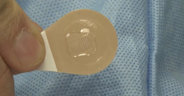 Flu vaccine patch seems as effective as flu shot - CBS News