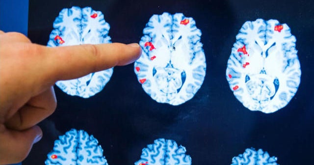 Researchers say there's evidence that consciousness continues after ...