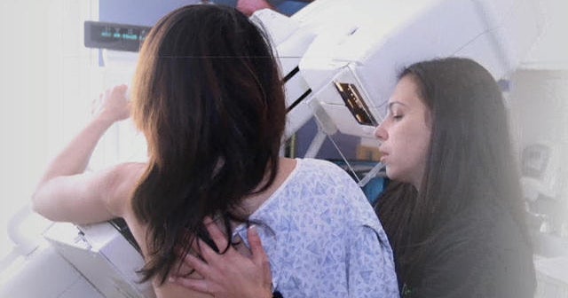 How to navigate differing breast cancer screening guidelines - CBS News