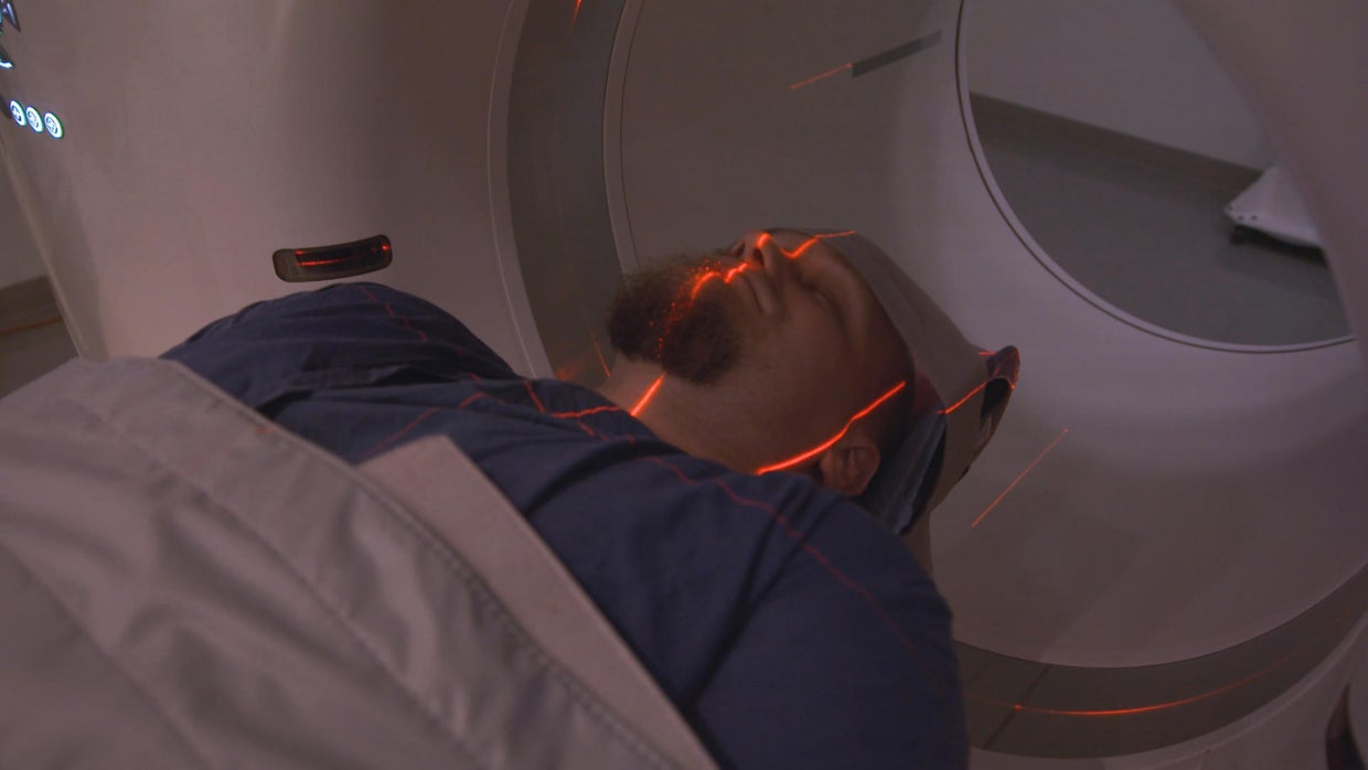 Scientists seek veterans to help treat CTE - CBS News