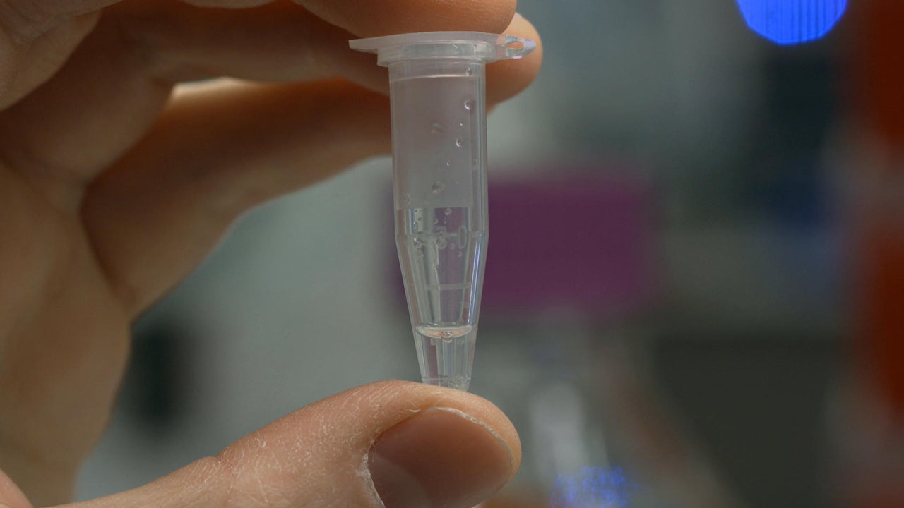 CRISPR news - Today’s latest updates - CBS News