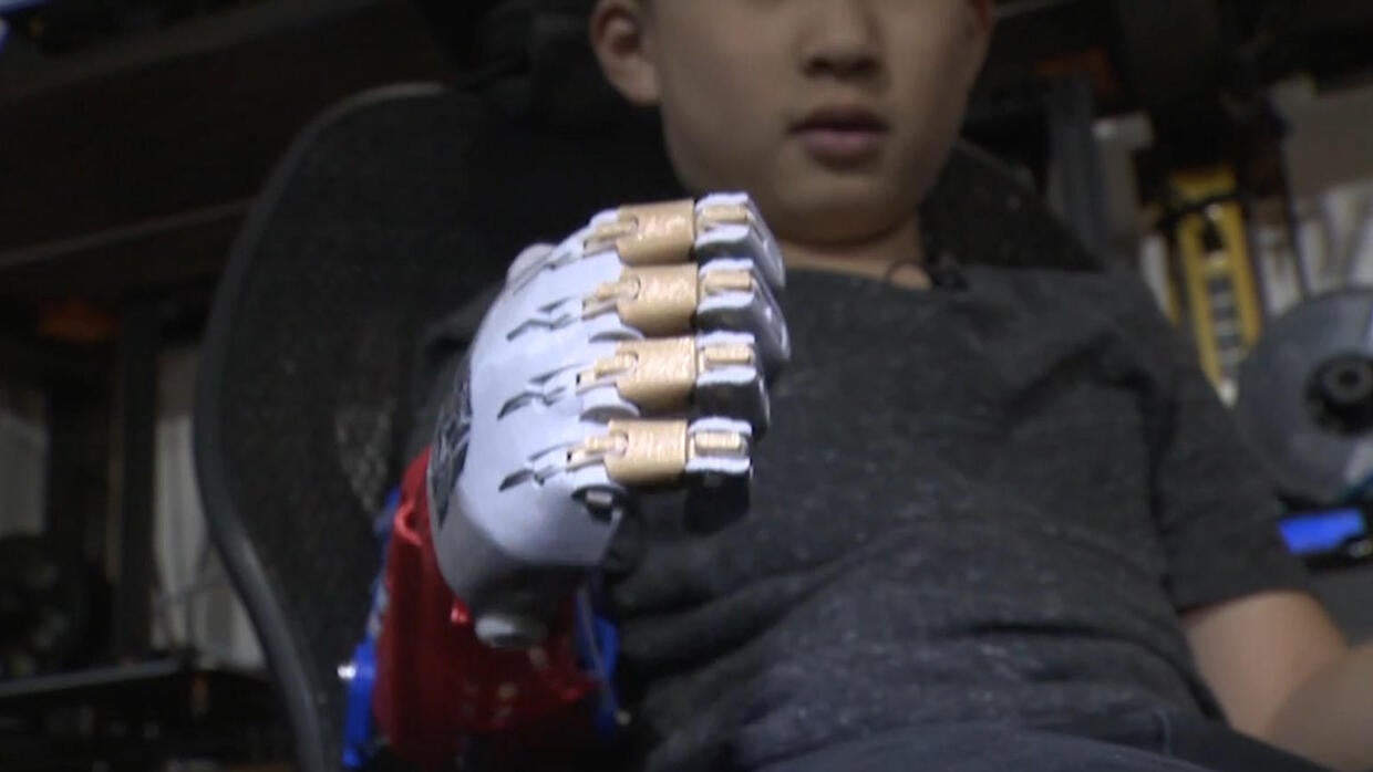 Boy missing part of his arm gets 3-D printed "upgrade" - CBS News