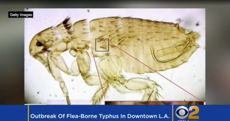 Downtown Los Angeles hit with outbreak of flea-borne typhus - CBS News