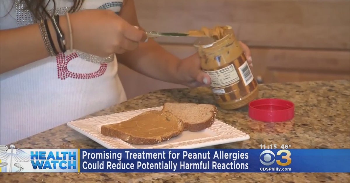 Promising Peanut Allergy Treatment Reduces Risk Of Life-Threatening ...