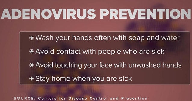 What's causing the adenovirus outbreak? - CBS News
