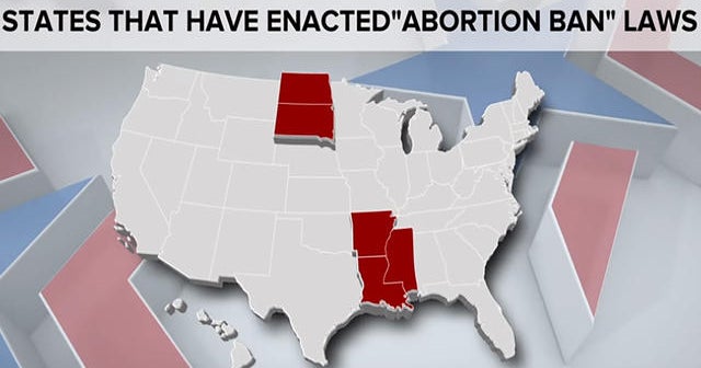 States moving to enact abortion "trigger" laws - CBS News