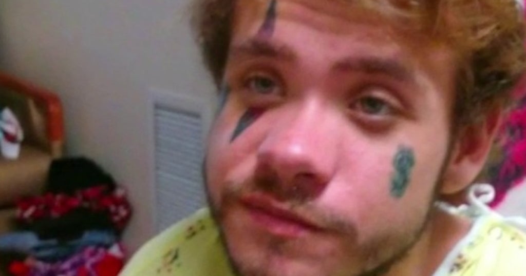 Police Man Sucker Punched Outside Bar Suffers Blindness Permanent Memory Loss Cbs Chicago