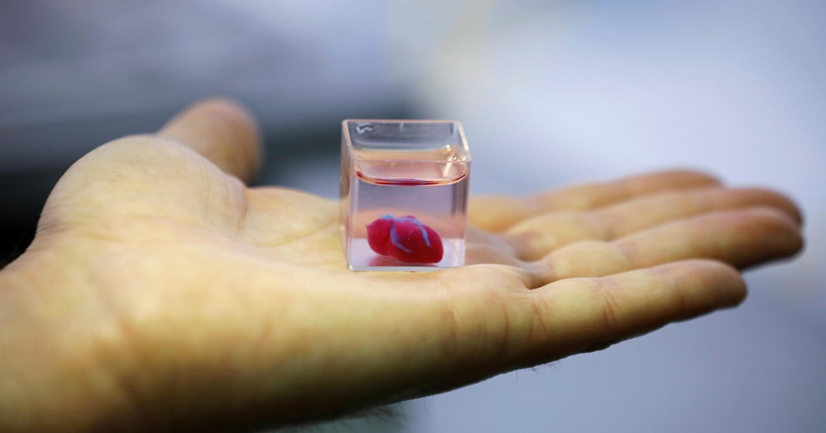 3D-printed heart a potential breakthrough in making human organs - CBS News