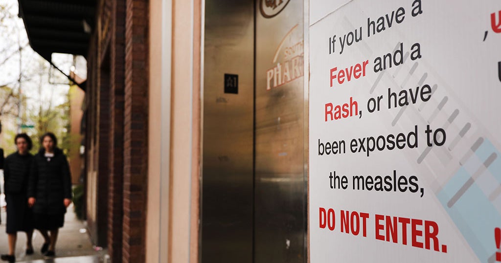 Measles Outbreak: Health Officials Comb Through New Jersey Restaurant ...