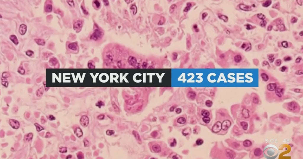 Measles Outbreak: NYC Health Officials Close 2 More Brooklyn Schools ...