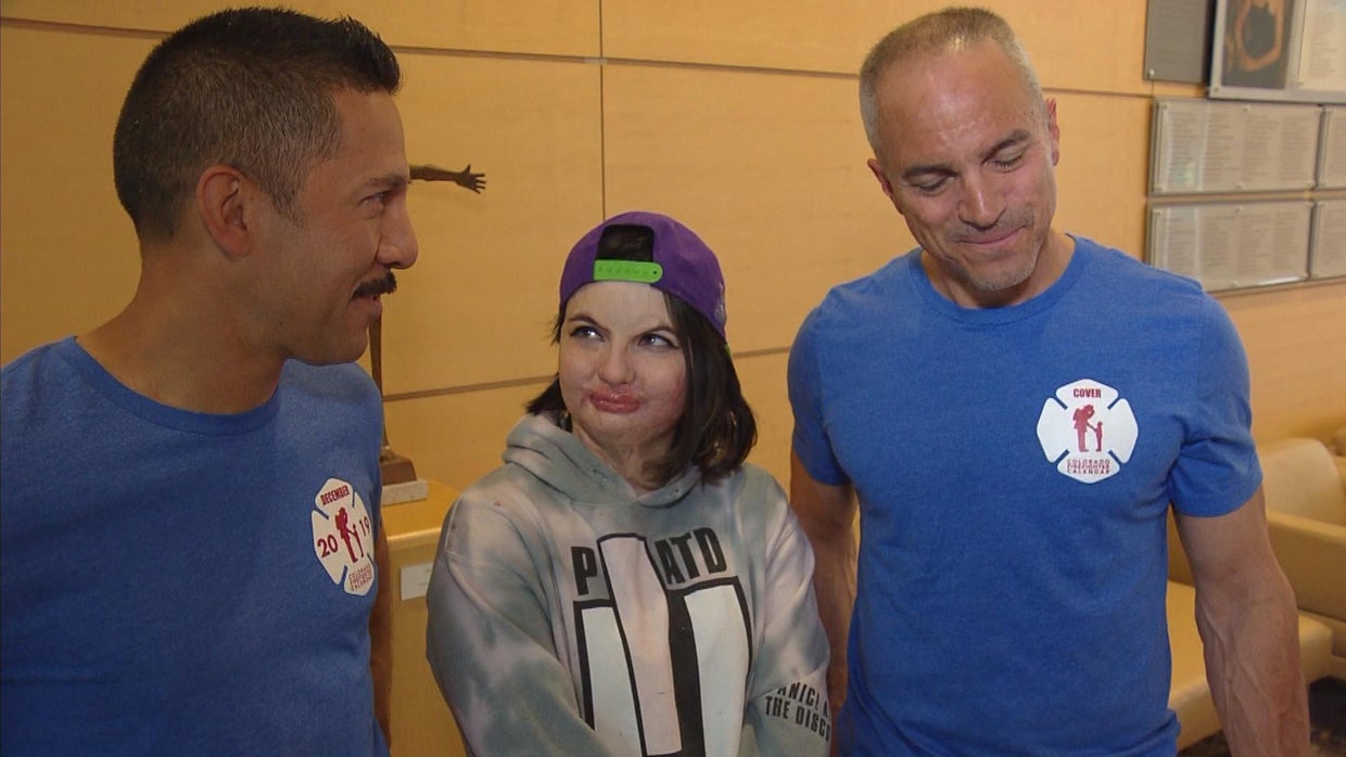 Firefighters Who Posed For Colorado Calendar Meet With 'Burn Ambassador ...