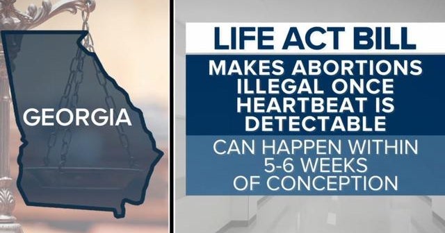 "Heartbeat bill" in Georgia would ban abortions after heartbeat ...
