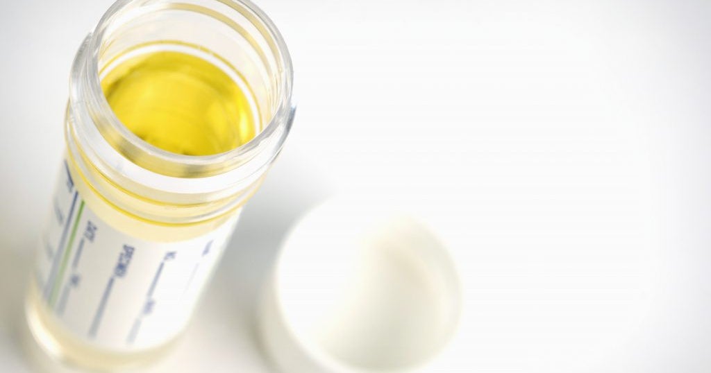 This Works Group Says Drinking Your Own Pee Is Good For You Cbs