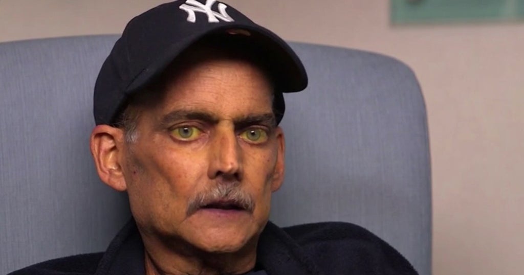 Wake Held For 9/11 First Responder Lou Alvarez - CBS New York