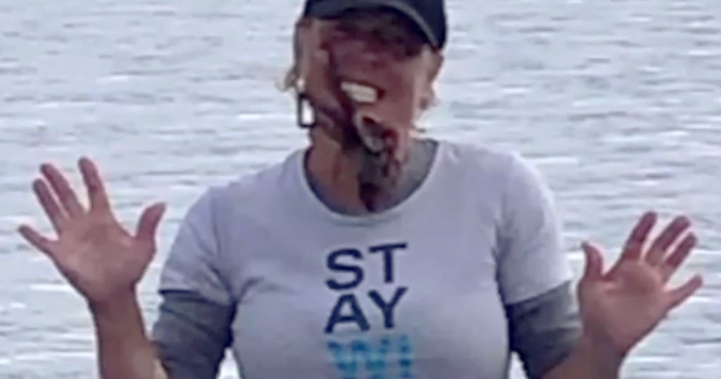 Octopus Bites Woman On Face During Ill-Advised Photo Opp - CBS Boston