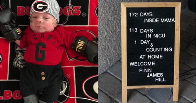 1-pound baby in NICU for 113 days finally goes home - CBS News