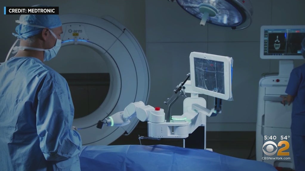 Doctors Turn To Robot For Help With Risky Scoliosis Surgeries - CBS New ...