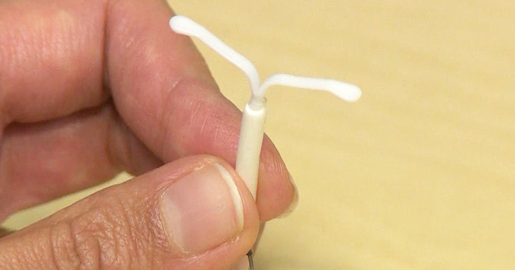Study: Women Who Use IUDs May Have Lower Risk Of Ovarian Cancer - CBS ...
