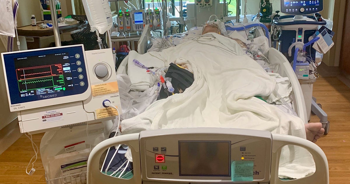 'The Day I Died': Dr. Dave Hnida Shares His Story - CBS Colorado