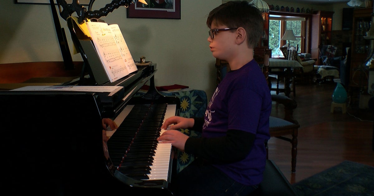 Boy Born With Facial Paralysis Is Expressing Himself Through Music ...