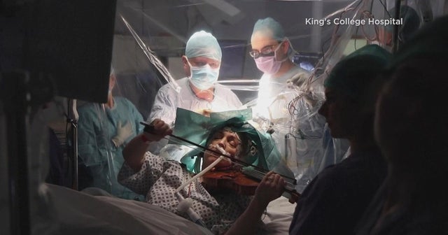 Woman plays violin to guide doctors during brain surgery - CBS News