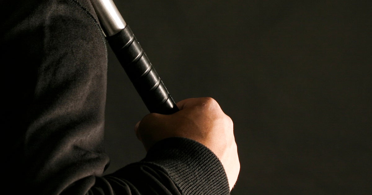 Man Accused Of Robbing, Assaulting Another Man With Baseball Bat In ...
