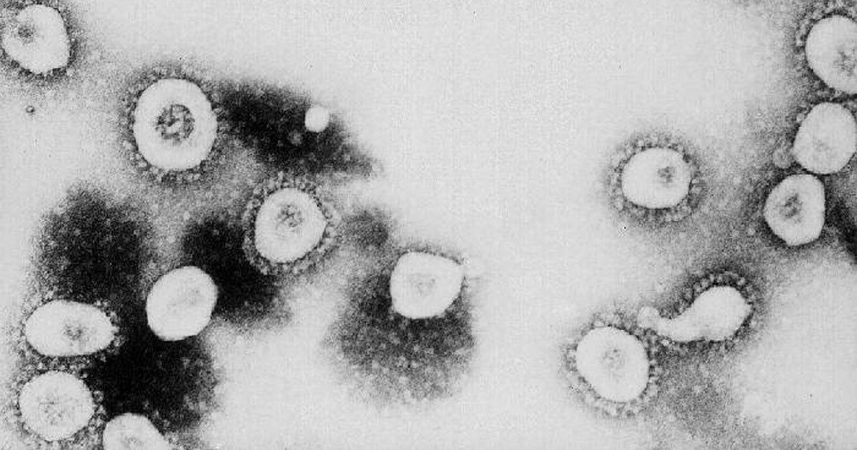 Trump administration announces $1.3M for fast virus test development ...