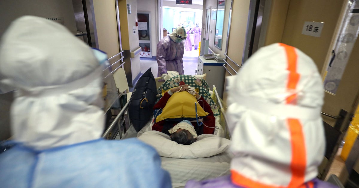 COVID-19: Cardiac Injury Among Hospitalized Coronavirus Patients Tied To Higher Risk Of Death In ...