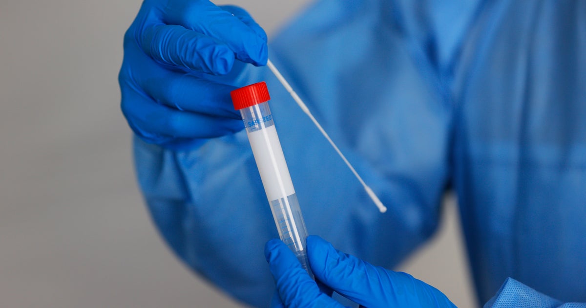 Coronavirus In Minnesota: COVID-19 Cases Rise By 304; 5 Additional ...