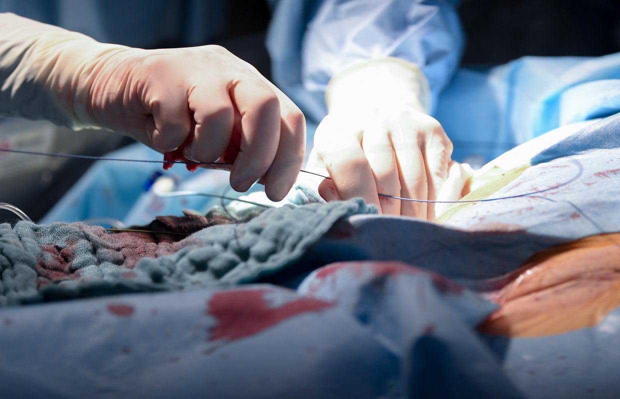 Most expensive medical procedures in the U.S., without insurance