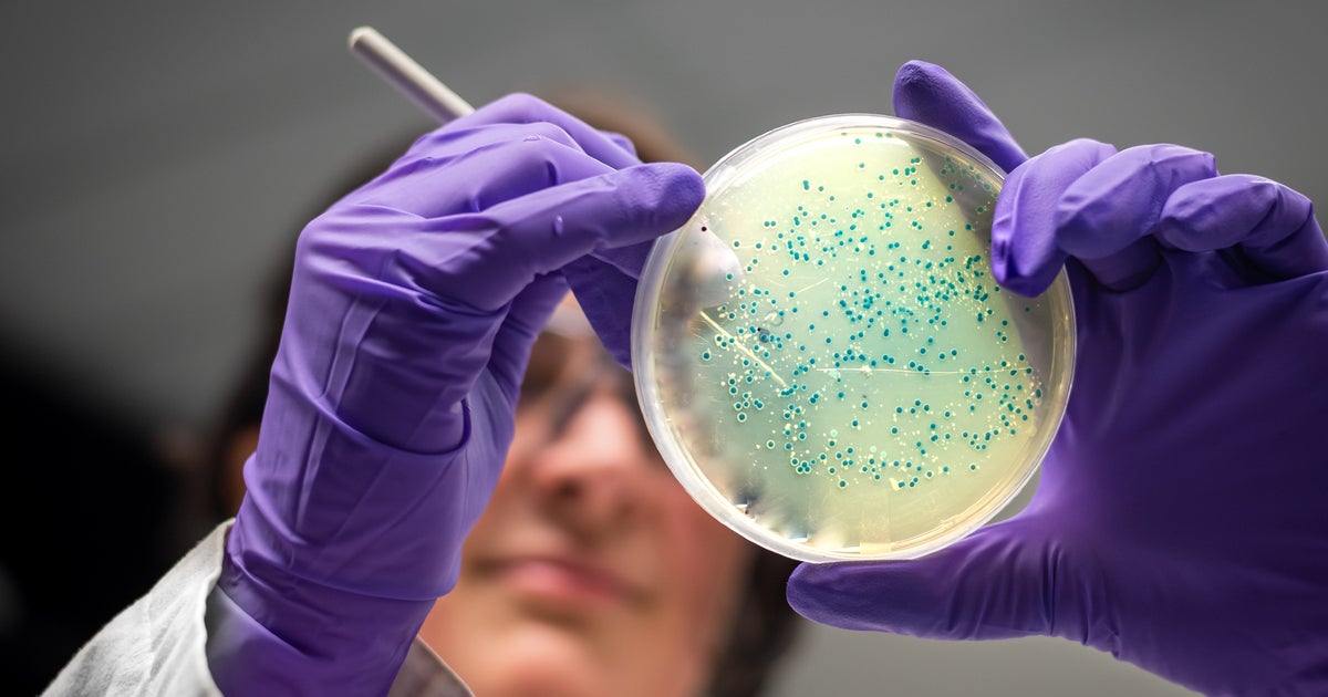 Scientists In California Accidentally Discover Bacteria That Eats Metal ...