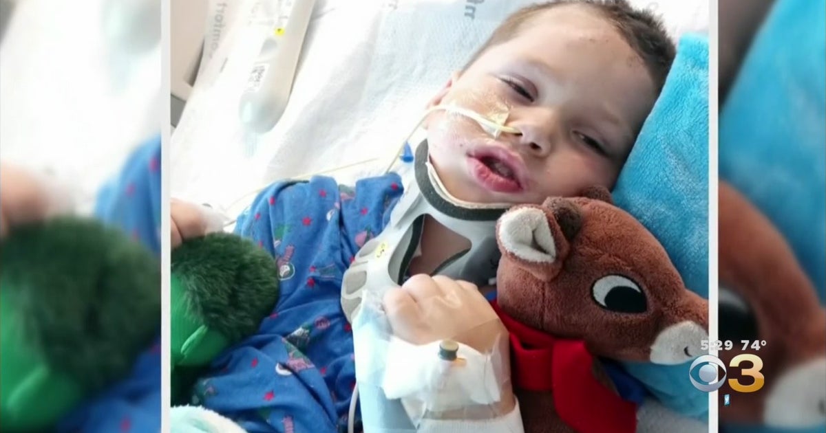 Search Continues For Hit-And-Run Driver Who Critically Injured 4-Year ...