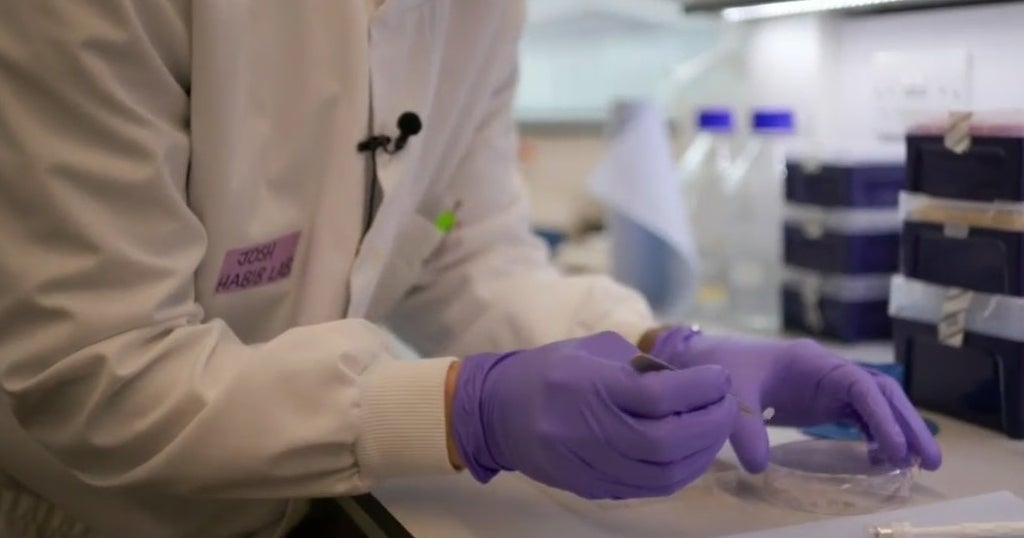 Researchers Find New Way To Heal Broken Bones With Futuristic Bandage ...