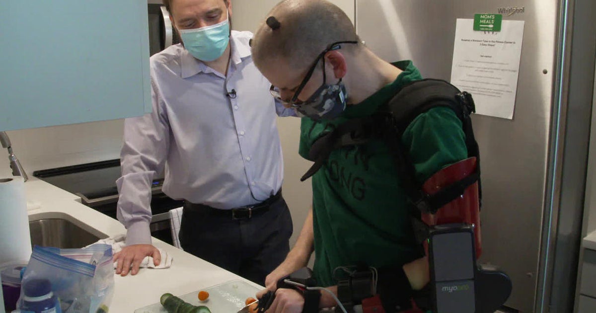 Meet a pioneer in stroke recovery - CBS News