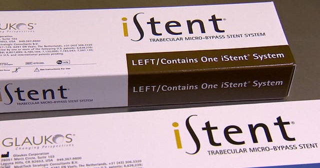 Tiny Implantable Device Helps With Glaucoma Cbs News