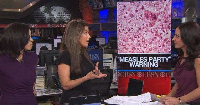 Should you take your child to a measles party? - CBS News