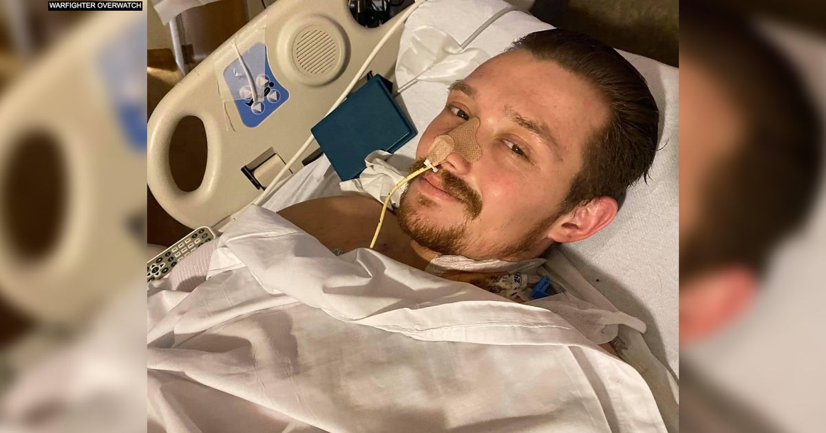 U.S. Marine Corps Sgt. Tyler Andrews Undergoes 25th Surgery Following ...