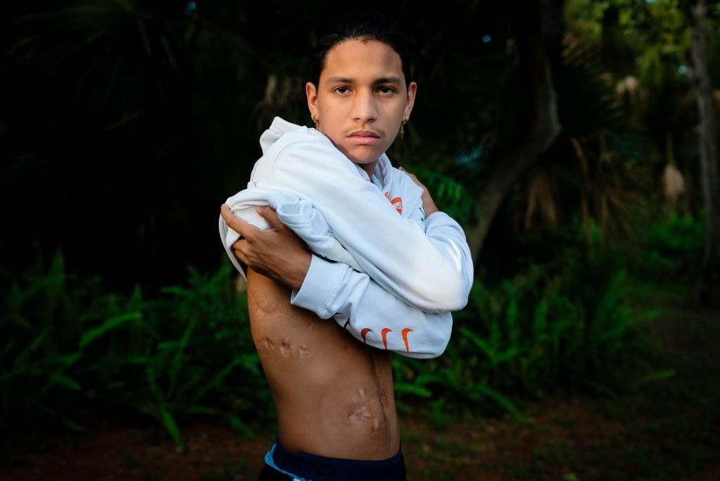 Parkland Survivor Anthony Borges Settles Lawsuit With Broward School ...