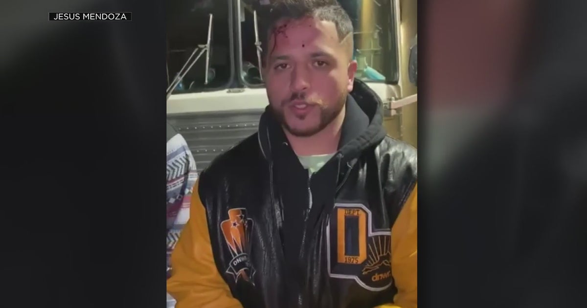Mexican Singer Assaulted, Robbed Outside Of Tracy Nightclub Before ...