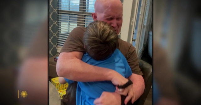 Stroke victim regains the power of giving hugs - CBS News
