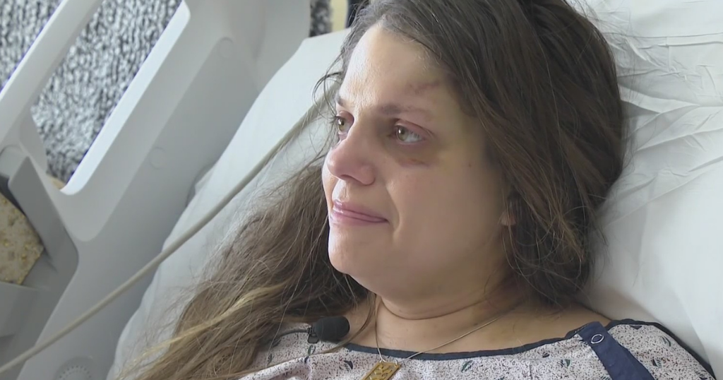 Peters Township mom run over by her own car - CBS Pittsburgh