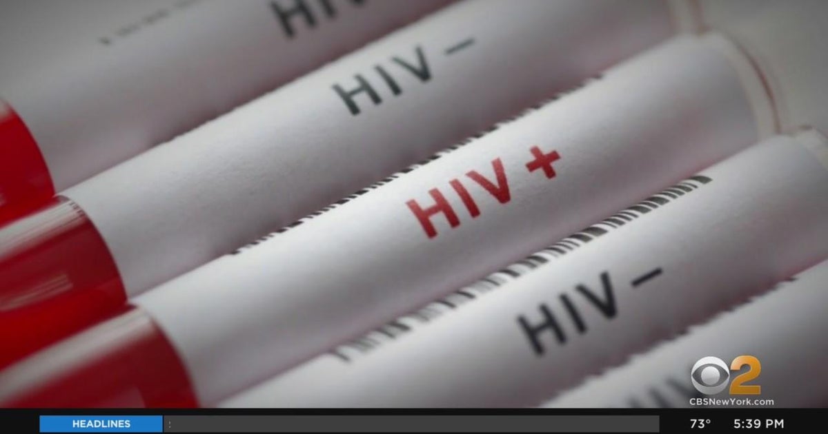 David Boger shares experiences as a long-term HIV survivor - CBS New York