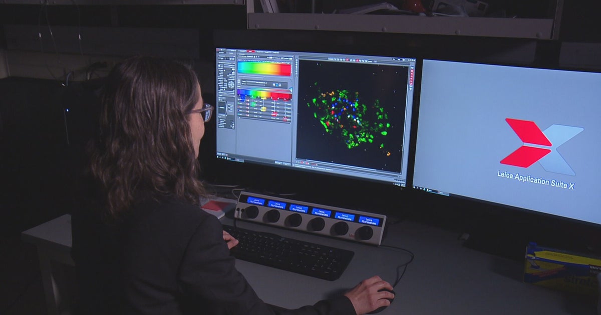 Colorado Researchers Working Toward A Cure For Type 1 Diabetes - CBS ...
