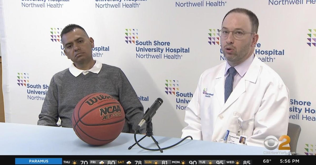 Doctors remove basketball-sized tumor from man's abdomen - CBS New York