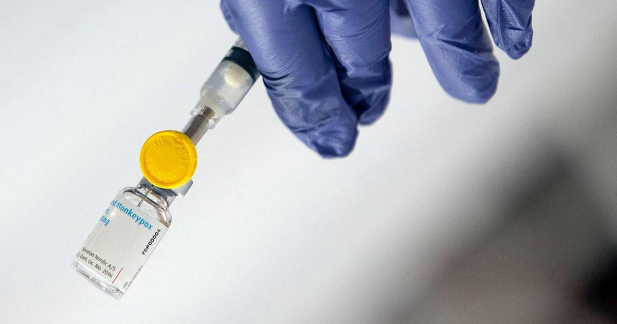 California toddler among 2 children now diagnosed with monkeypox in US ...