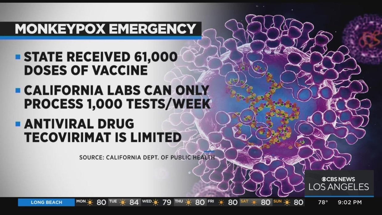 Gov. Newsom declares state of emergency over monkeypox - CBS Los Angeles