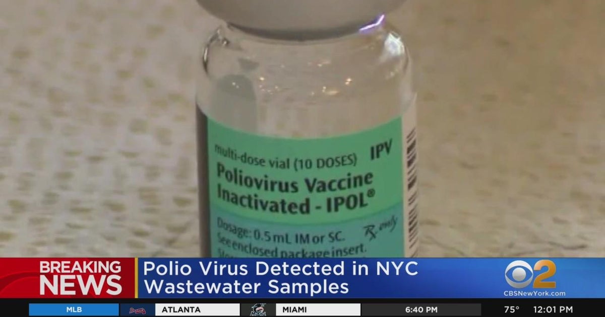 Polio detected in NYC wastewater samples - CBS New York