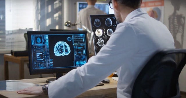 AI revealing new insights about neurological health - CBS News