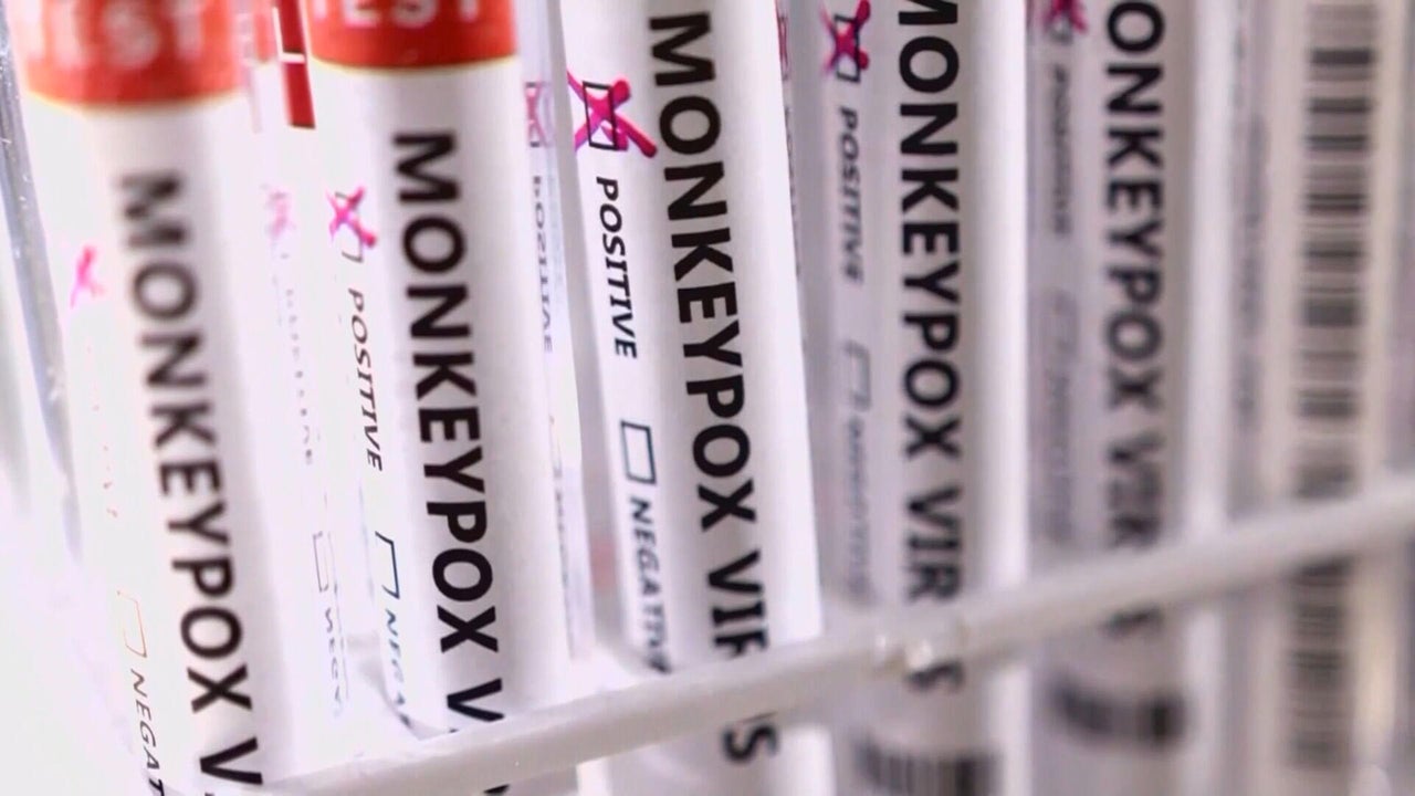 Monkeypox news - CBS Minnesota