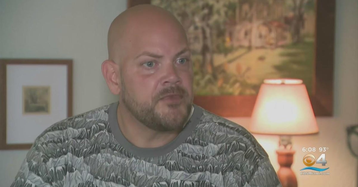 Some report uncomfortable side effects after monkeypox vaccine - CBS Miami